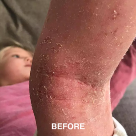 Why Calcium is Essential for Glowing Skin: Top 3 Reasons to Add It to